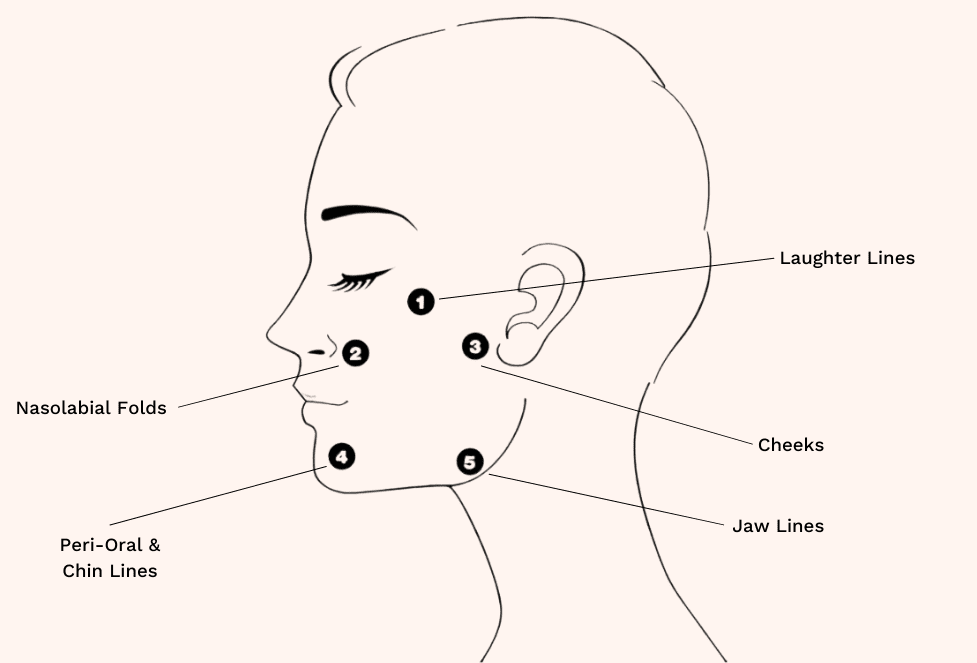 Profhilo and Skin Boosters In Warrington, Cheshire - SkinGenius Clinic